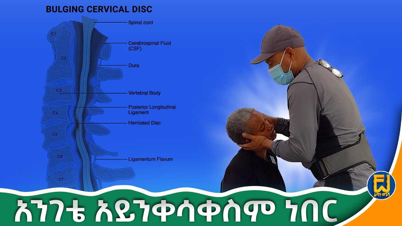 አንገቴን ለማዞርም ወደላይ ወደታች ለማድረግም እቸገር ነበርetanu#wegesha#ethiopia - YouTube
