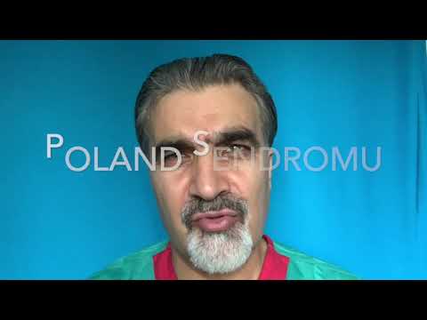 Poland Sendromu tedavisi nelerdir? Göğüs deformitesi
