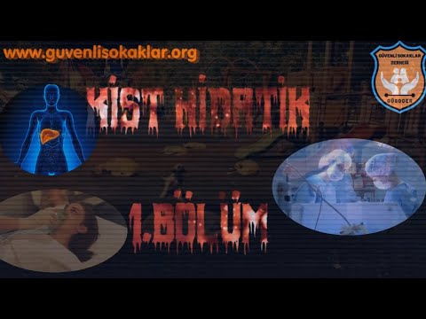 Kist Hidatik Hastalığı 1.bölüm