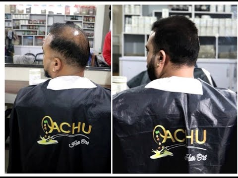 A pleased client who used Yachu Hair Oil and experienced Hair Regrowth ...