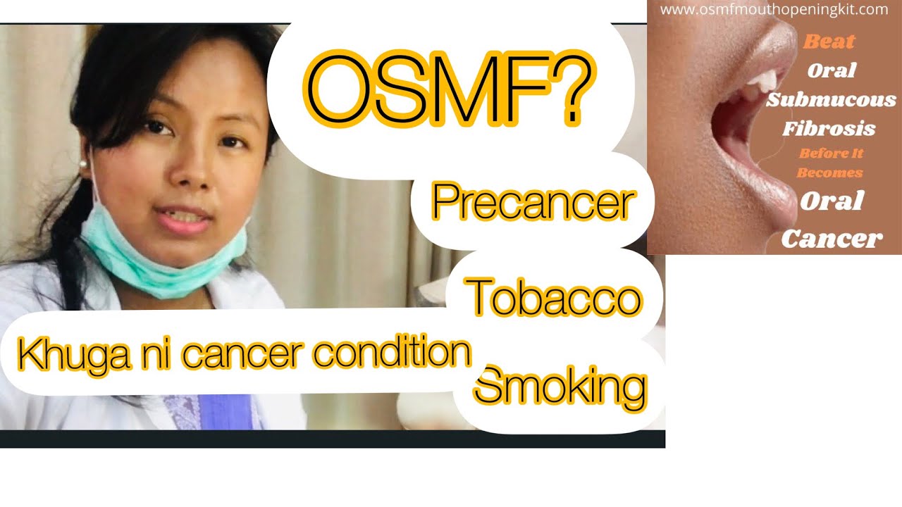 OSMF/Oral submucos Fibrosis /Precancer condition /Swrnao jayw bangsin ...
