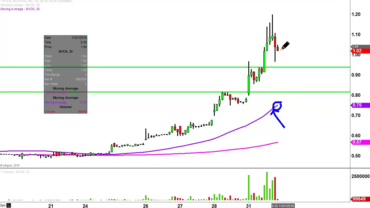 Neovasc Inc - NVCN Stock Chart Technical Analysis for 10-31-16 - YouTube
