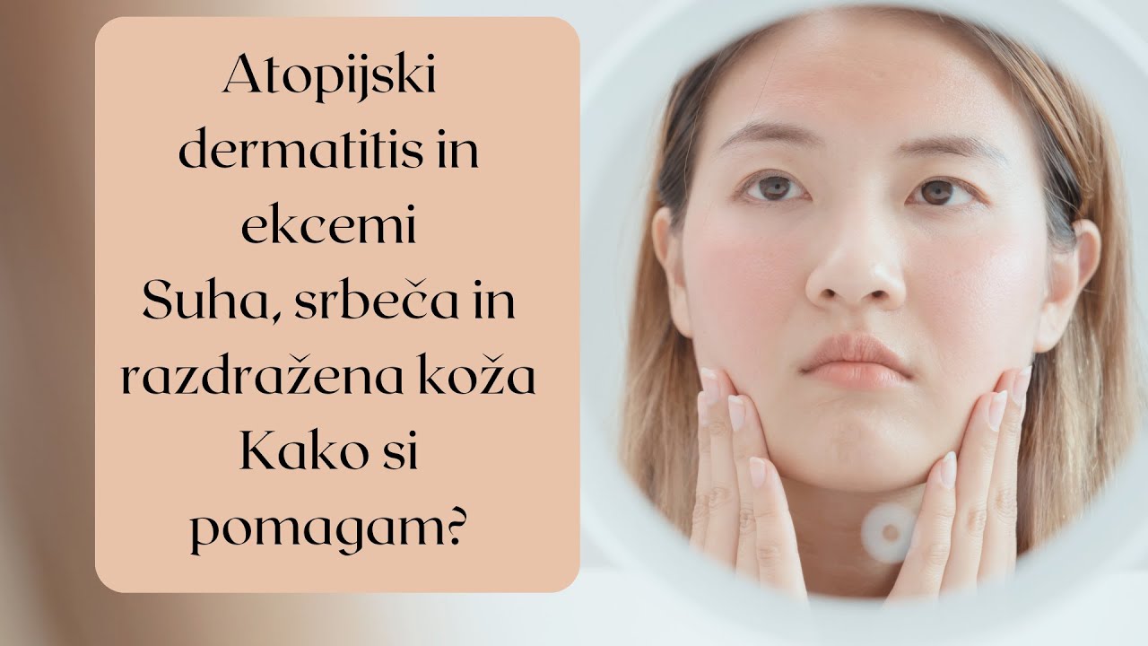 Atopijskii dermatitis in ekcemi - YouTube