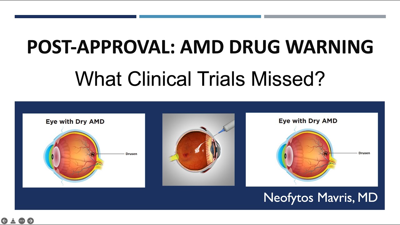 Post-Approval Insights: Adverse Events of AMD Treatments ...