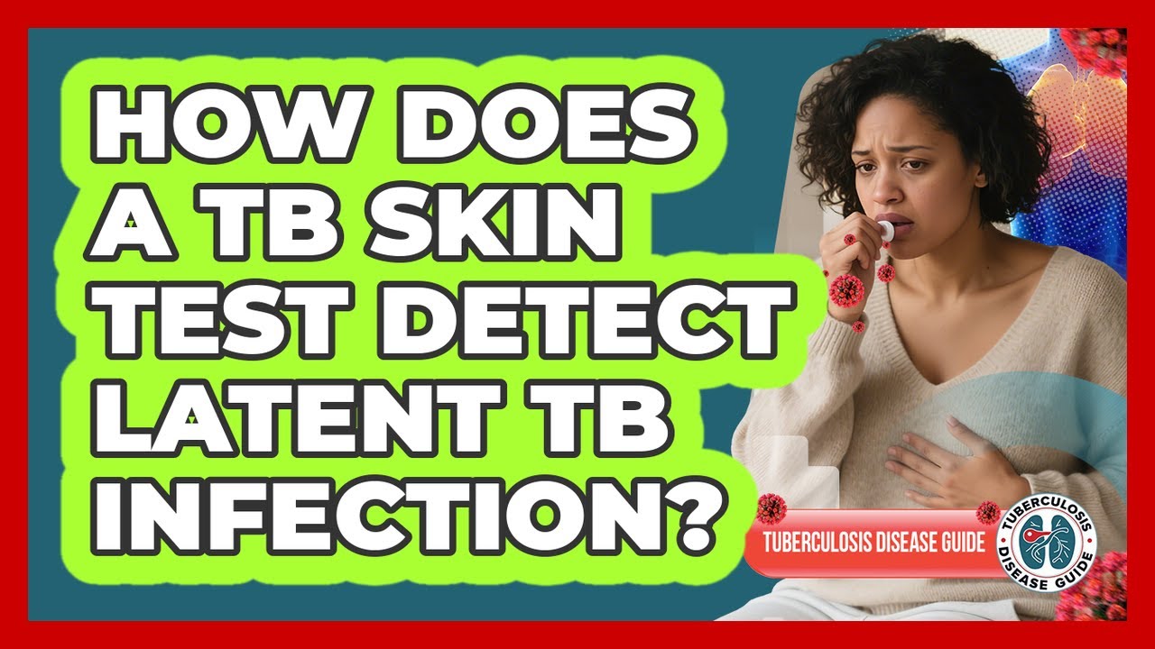 How Does A TB Skin Test Detect Latent TB Infection? - Tuberculosis ...