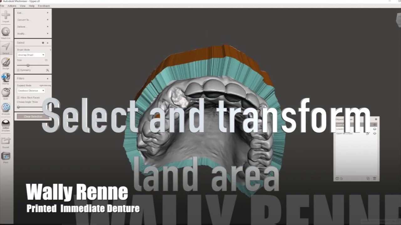 Meshmixer Immediate Denture 3D printed - YouTube