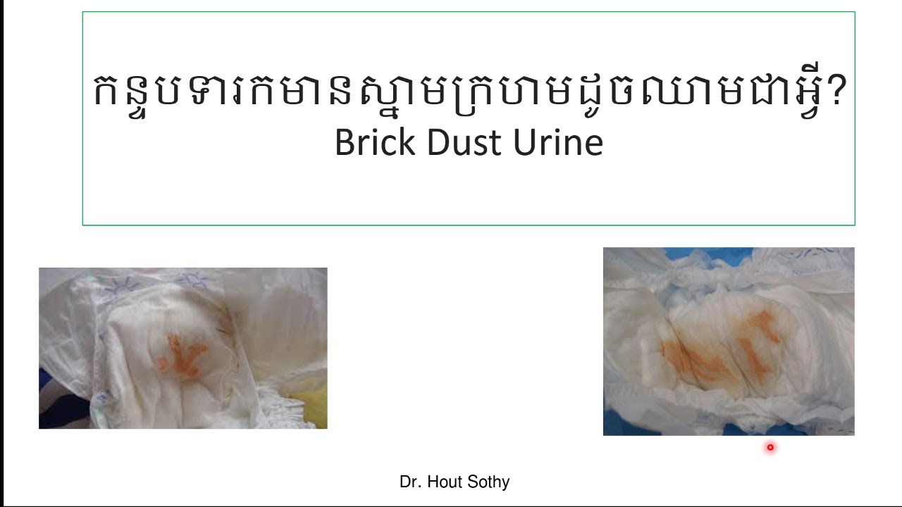 កន្ទបទារកមានស្នាមក្រហមដូចឈាមជាអ្វី? brick dust urine - YouTube