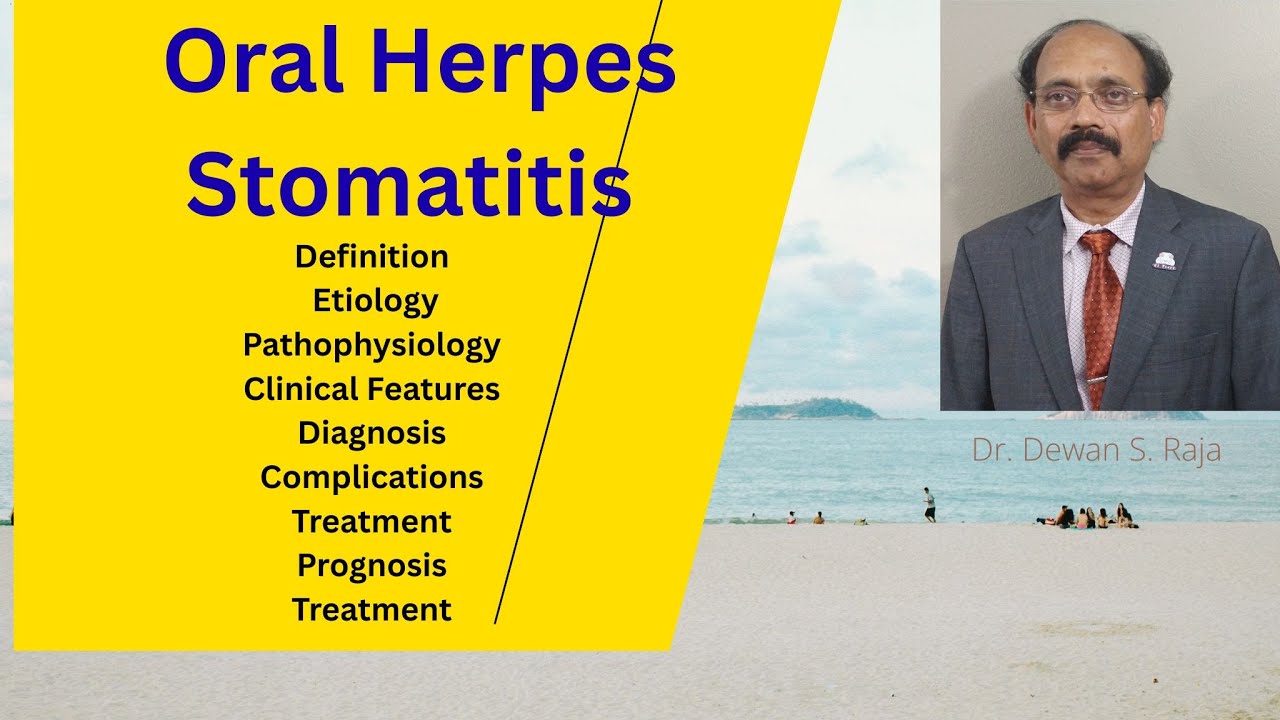 Oral Herpes Stomatitis (Primary Herpetic Gingivostomatitis) - YouTube