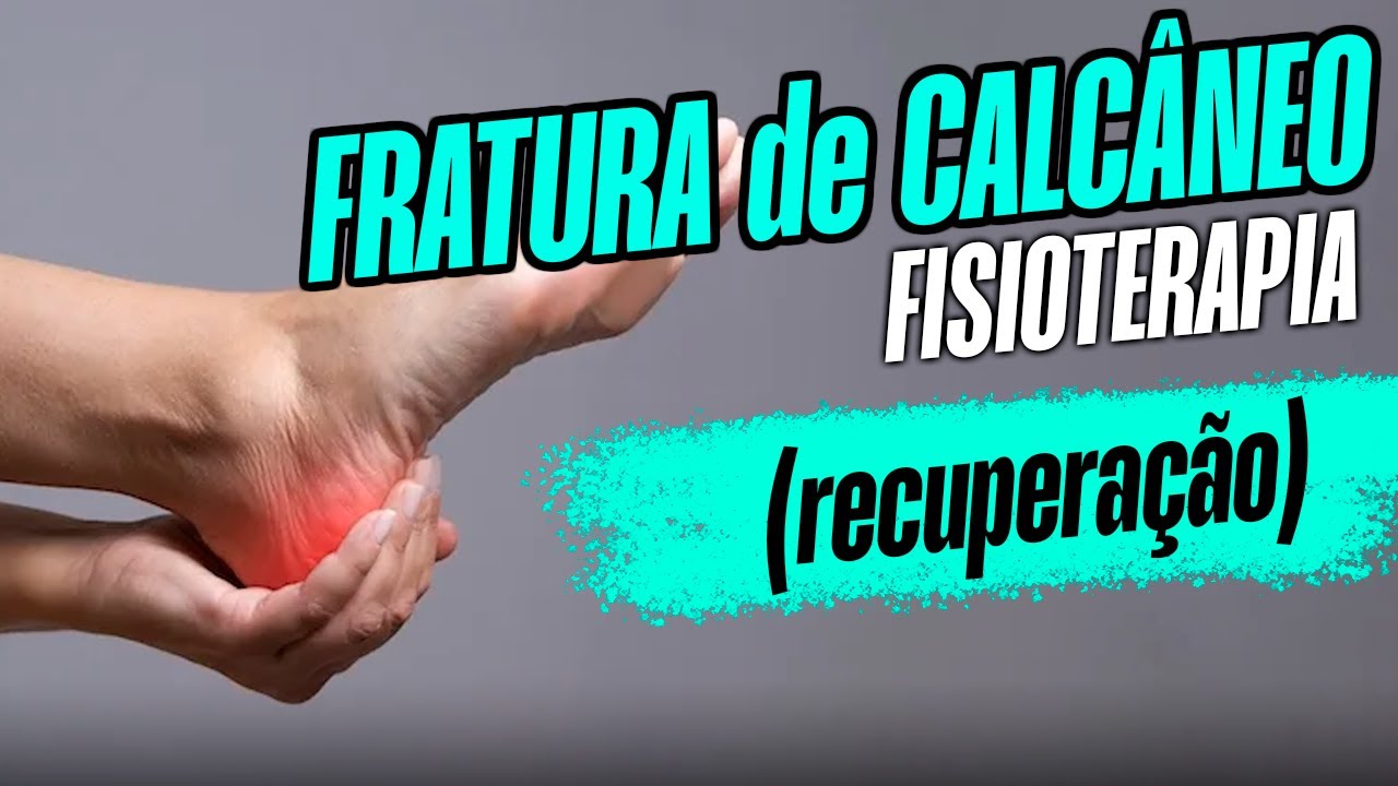 FRATURA no CALCANHAR RECUPERAÇÃO com FISIOTERAPIA PÓS CIRURGIA - Dr ...
