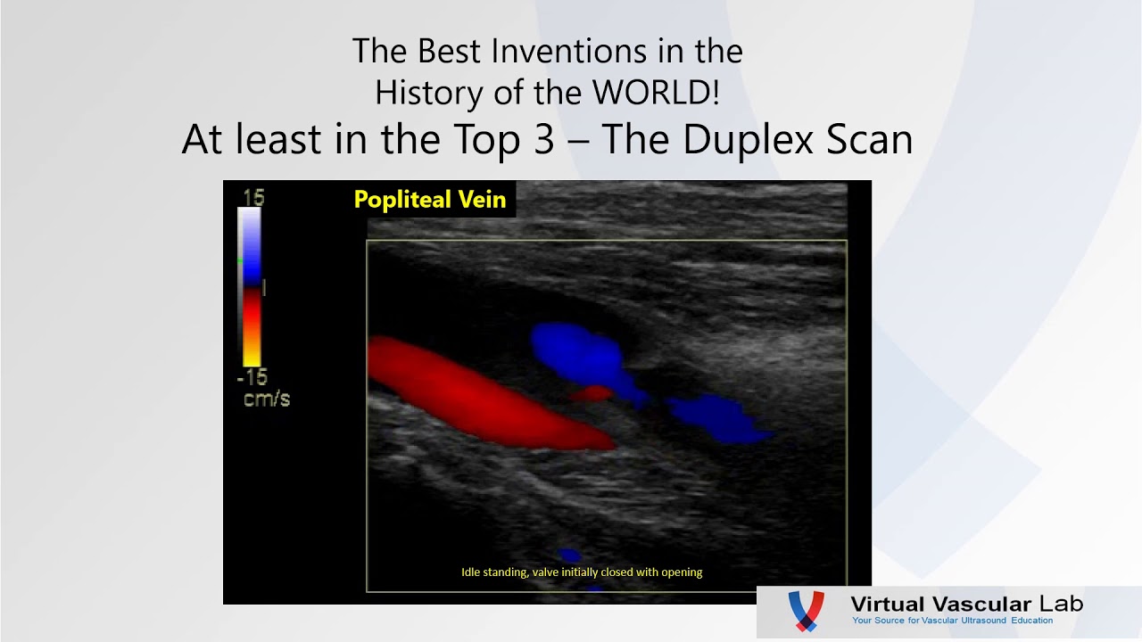 Duplex Scan Interpretation - Virtual Vascular Lab Channel - YouTube