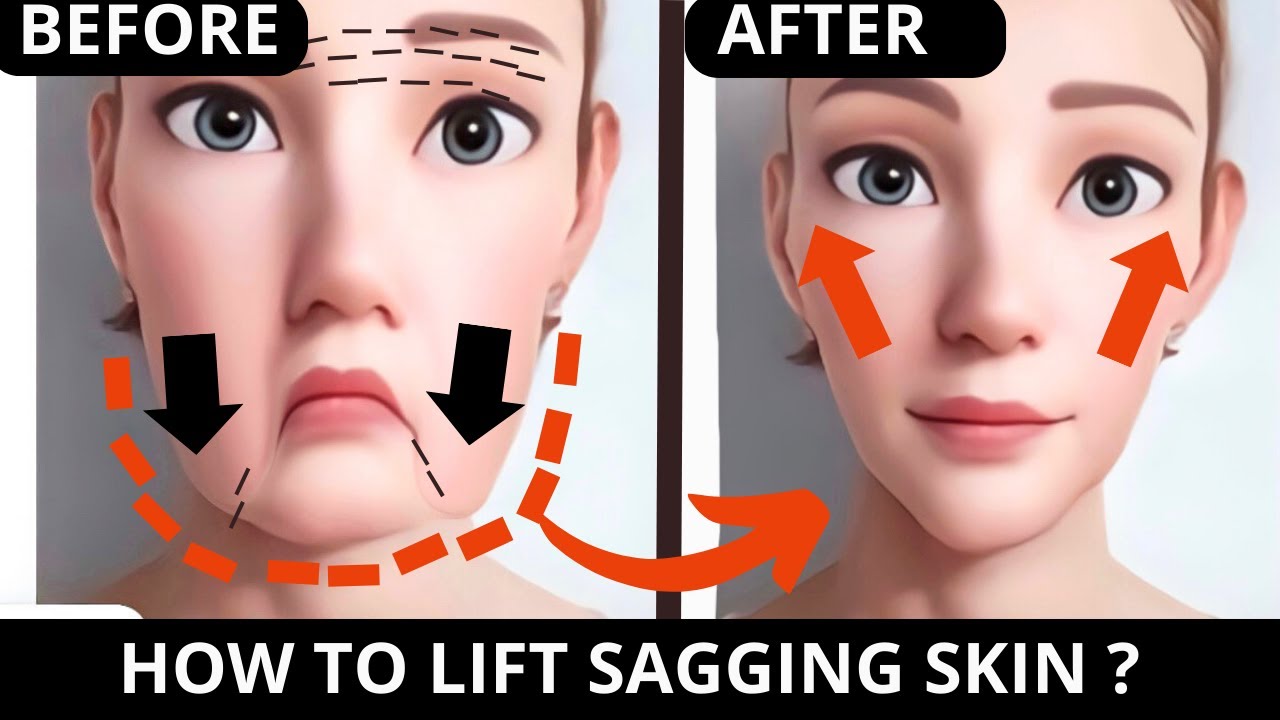 🛑 ANTI-AGING EXERCISES FOR SAGGING SKIN, JOWLS, LAUGH LINES, FOREHEAD ...