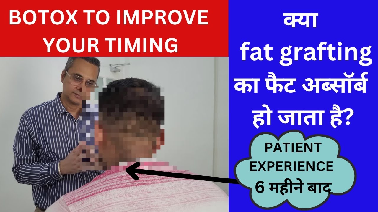 Penile Fat Grafting . Botox to improve timing ( Patient after 6 months ...