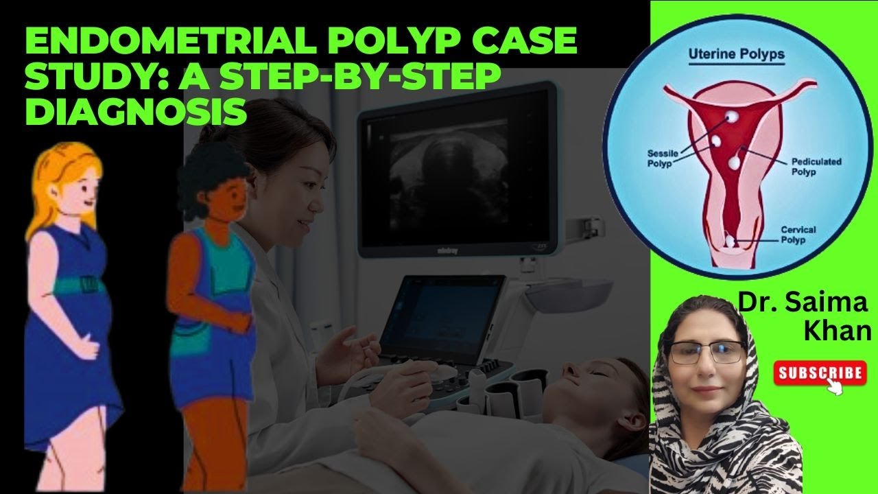 Endometrial Polyp Case Study: A Step-by-Step Diagnosis #health #ultrasound #polyp @Dr.Saimakhan ...