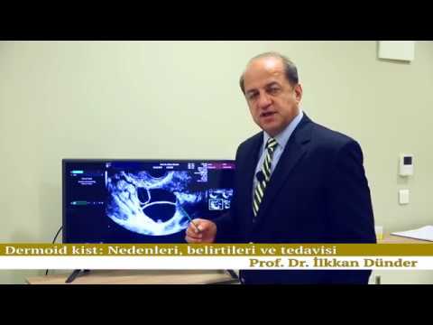 Dermoid kist: Nedenleri, belirtileri ve tedavisi.