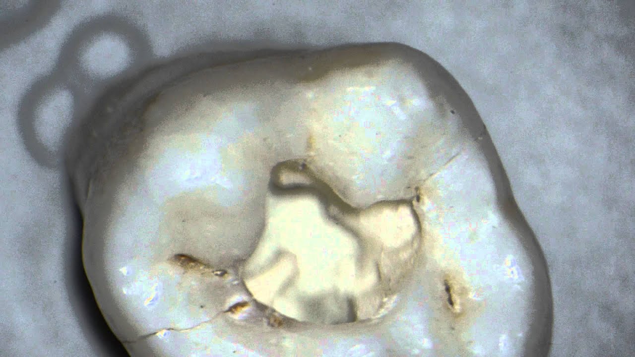 Labomed dental microscope magnification - YouTube
