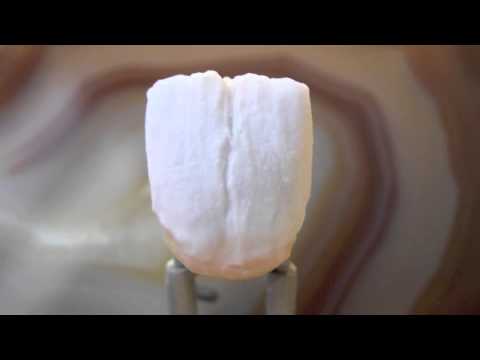 Making front teeth (Creation) - YouTube