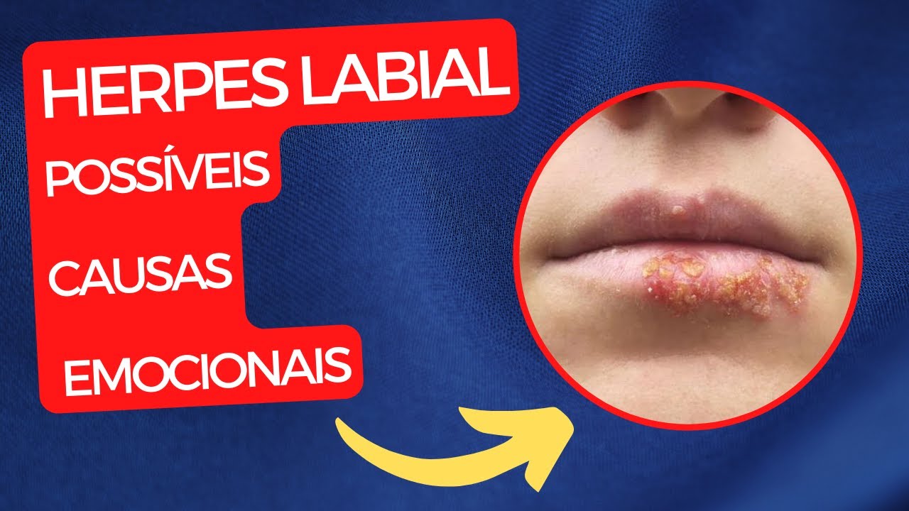 HERPES LABIAL: POSSÍVEIS CAUSAS EMOCIONAIS - YouTube