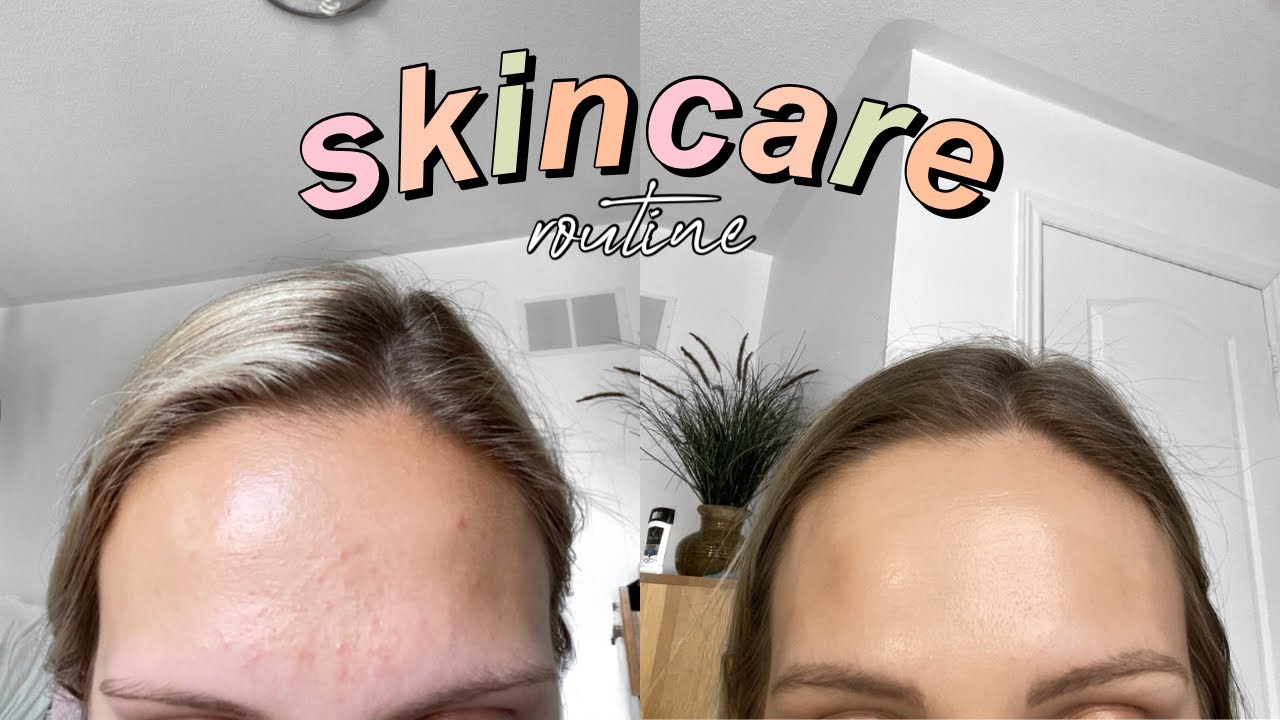 how to get rid of tiny bumps on forehead & texture - YouTube