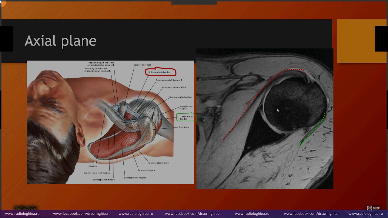 Lectie umar anatomie de baza power point - YouTube