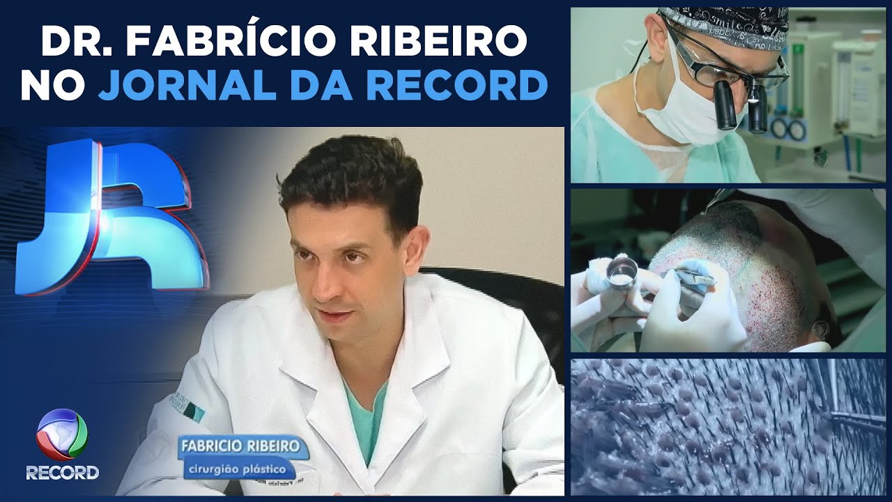 Implante Capilar Técnica FUE - Dr. Fabrício Ribeiro - Jornal da Record ...