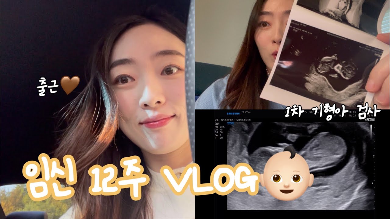 시험관 임신 Vlog 1차 기형아 검사 목투명대 검사 가짜 입덧 임산부의 먹방 기록 성심당 임산부패스 시험기간 데이트 하이베베 선물 Youtube