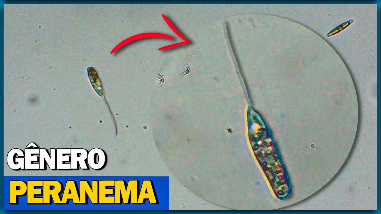 Protozoarios Flagelados Biodiversidad De Protistas (flagelados