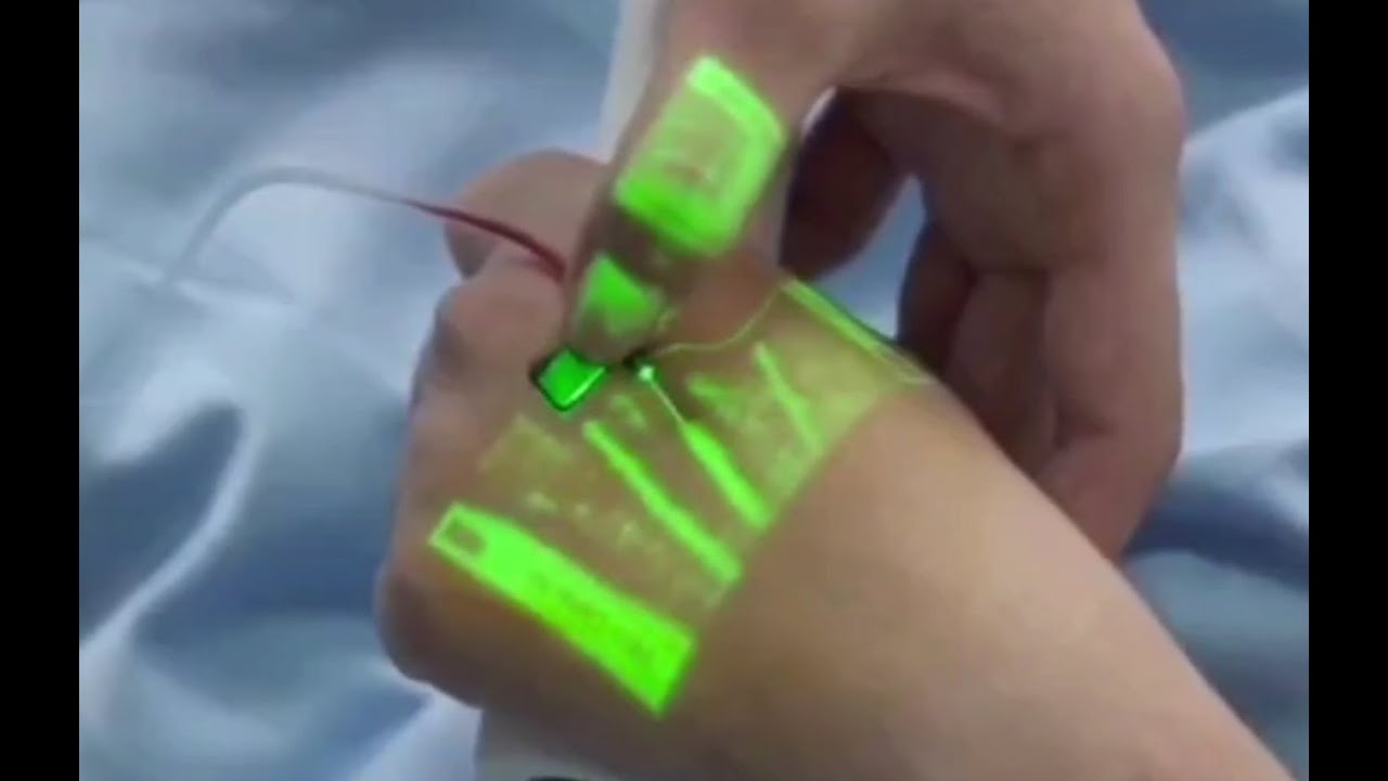 Introduction for VD80 Vein detector - YouTube