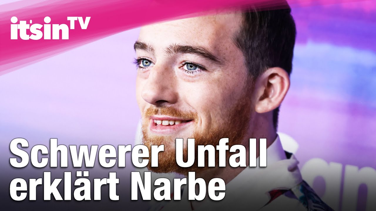 „Euphoria“-Star Angus Cloud: Riesige Narbe am Kopf – DAS ist passiert ...