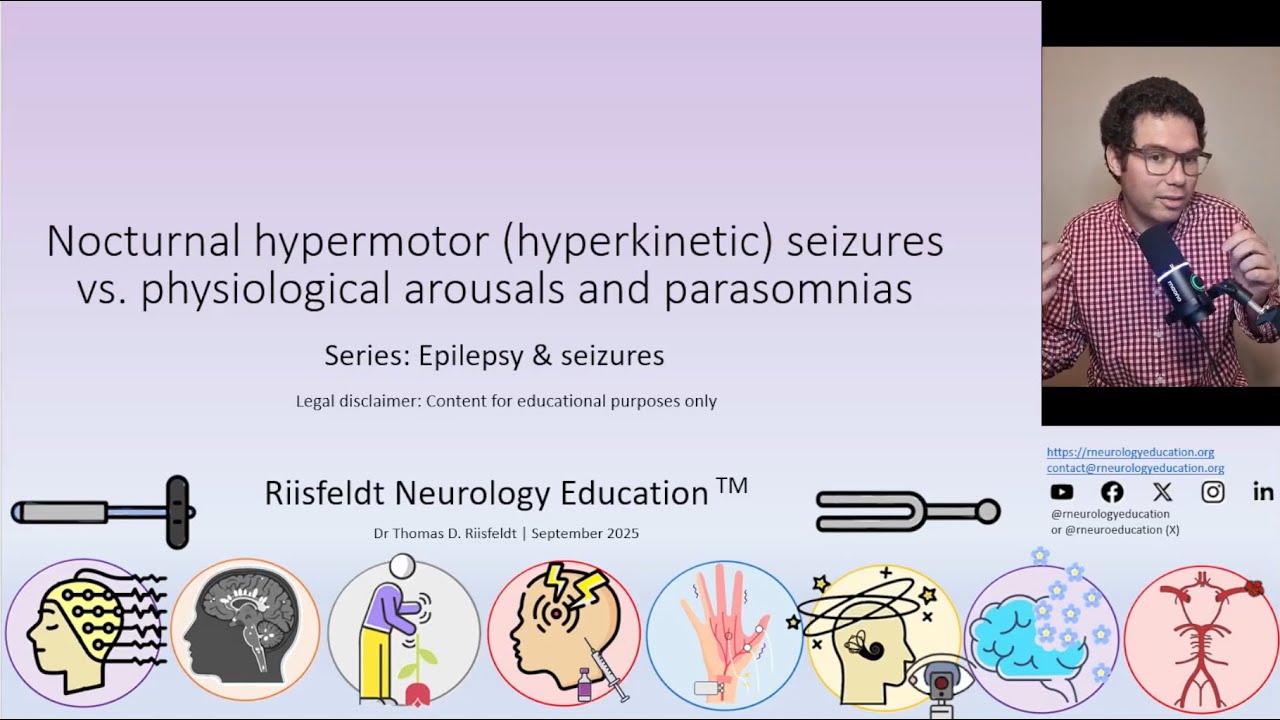 Nocturnal hypermotor (hyperkinetic) seizures vs. physiological arousals ...