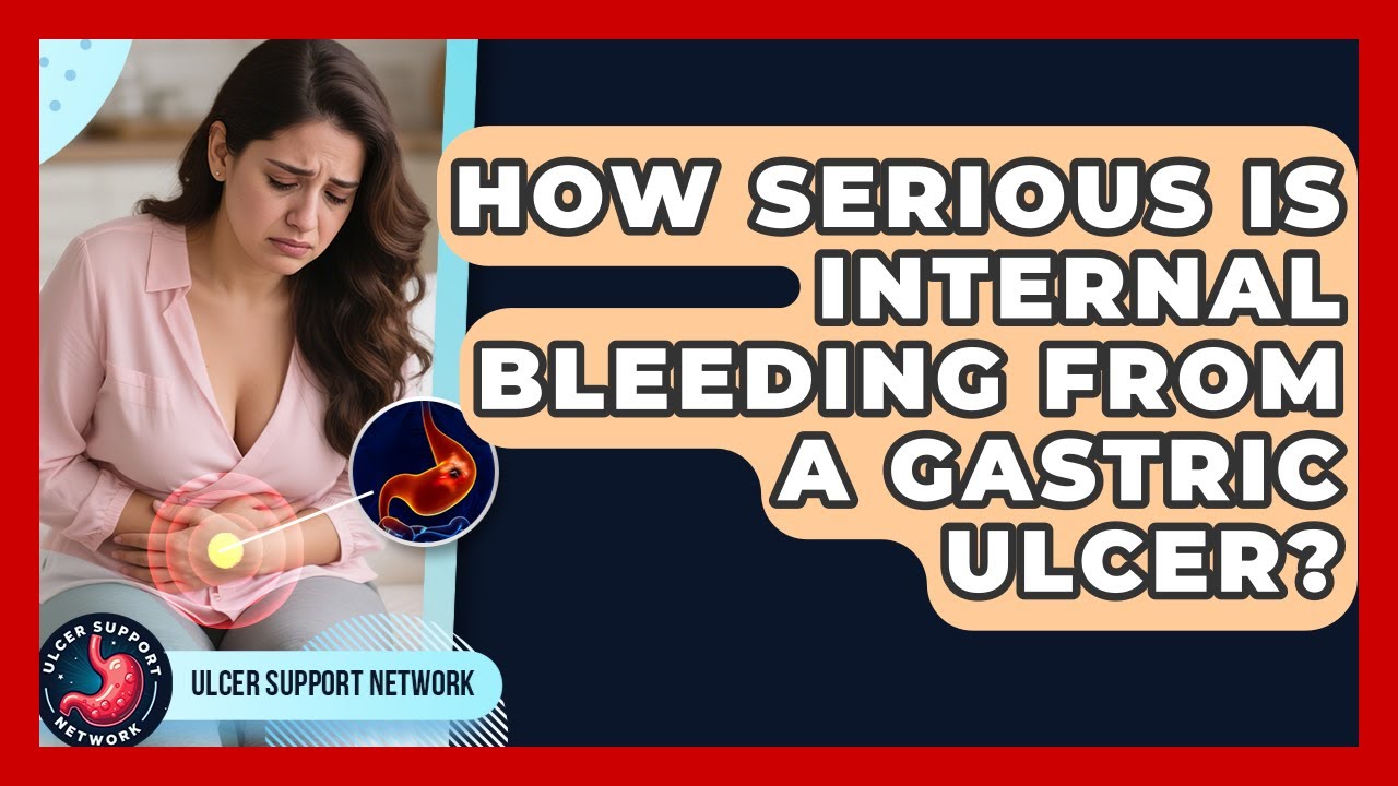 How Serious Is Internal Bleeding From A Gastric Ulcer? - Ulcer Support ...