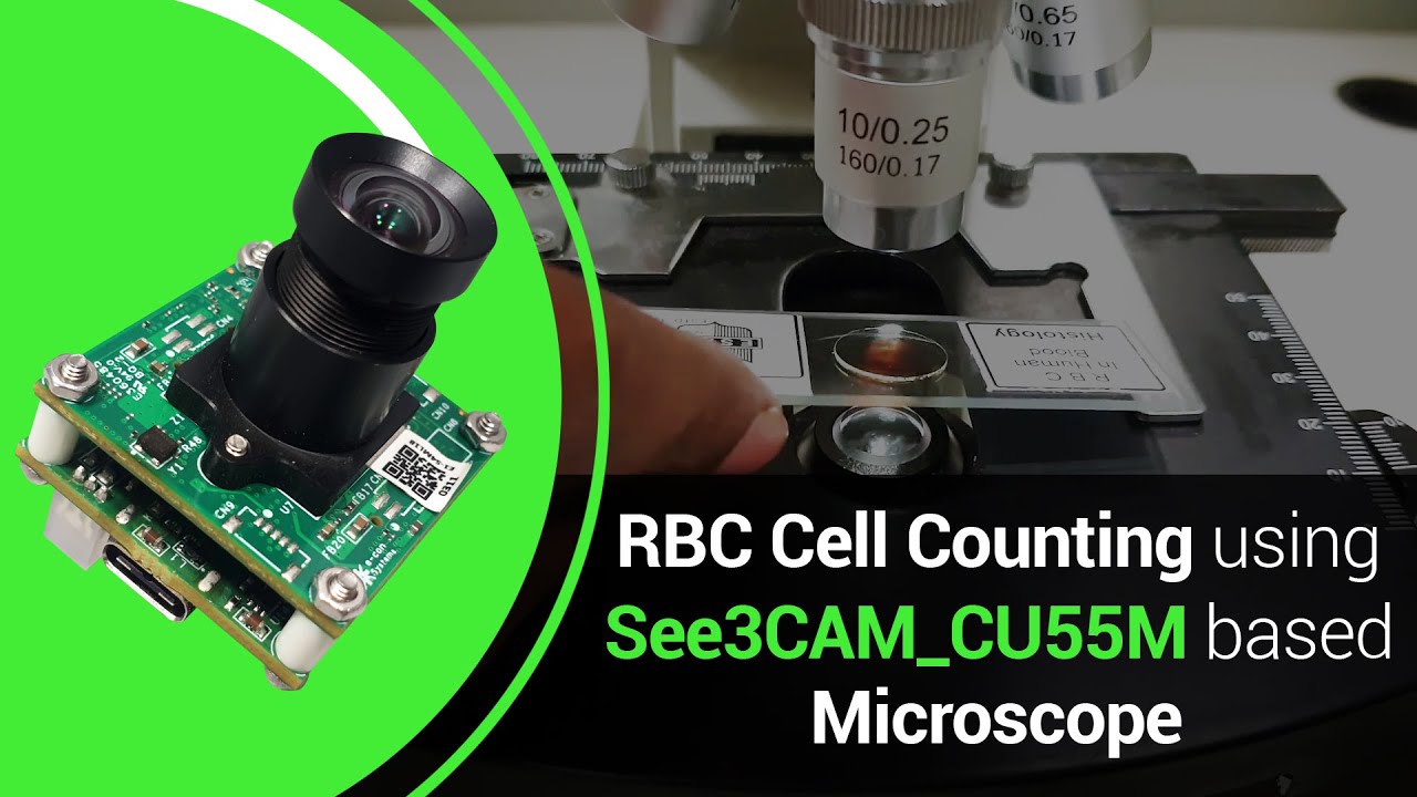 Monochrome camera for Digital Microscope | RBC cell counting using ...