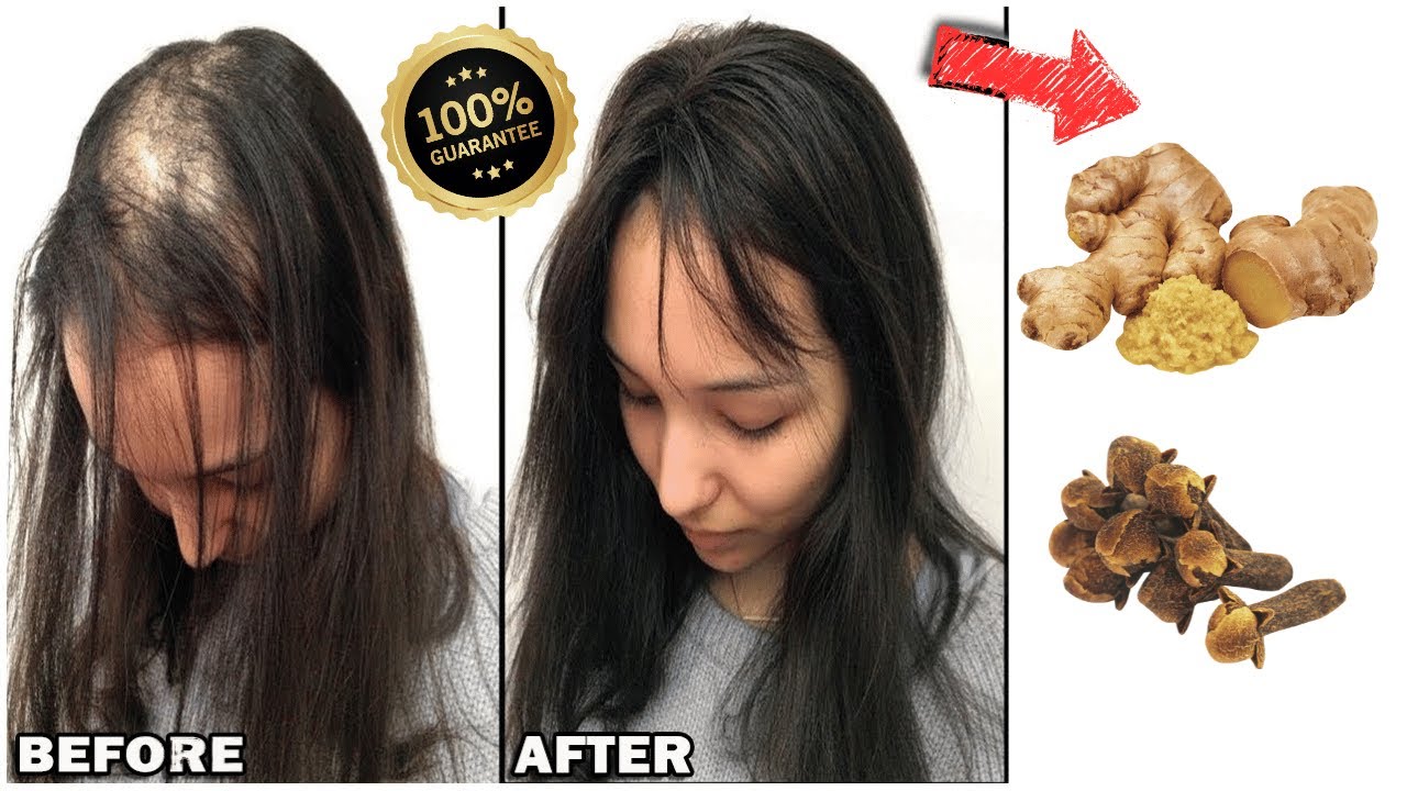 Indian secret 🤫, to grow hair at rocket speed and treat baldness ,you ...