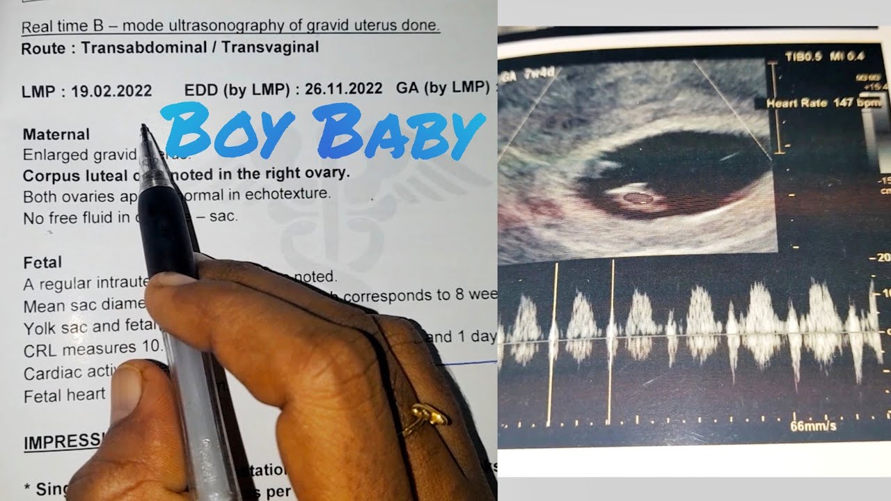 Baby boy's 1st month scan report - 7 weeks scan - YouTube