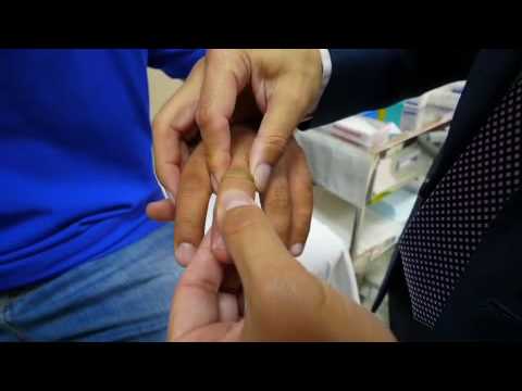 PIP joint exam - YouTube