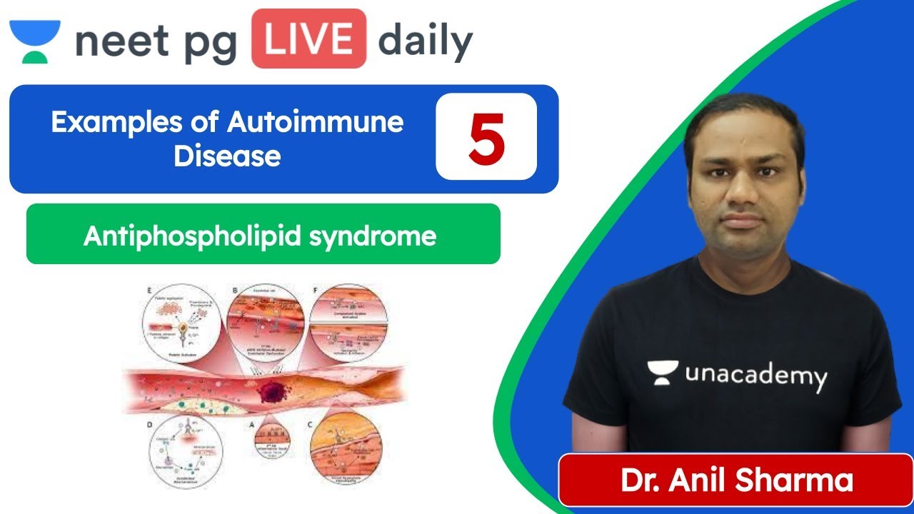 NEET PG: Autoimmune Disease | Antiphospholipid Syndrome | Unacademy ...