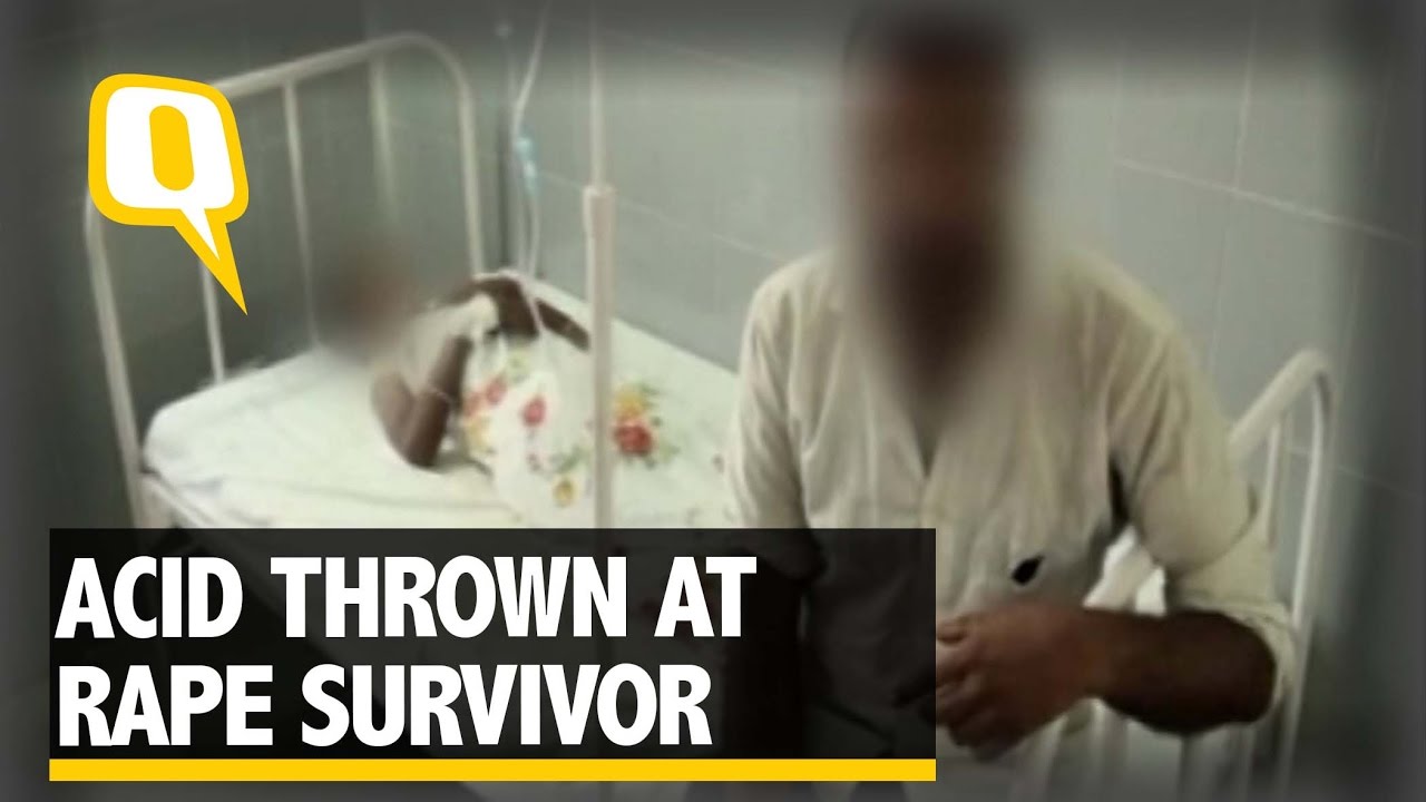 The Quint: First They Came For Her Body, Then They Scarred Her Face ...