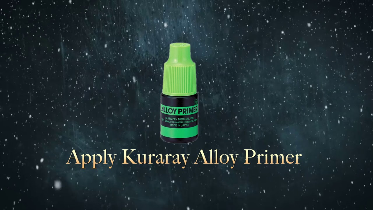 ''Broken porcelain repair of PFM Crown or Bridge'' - YouTube