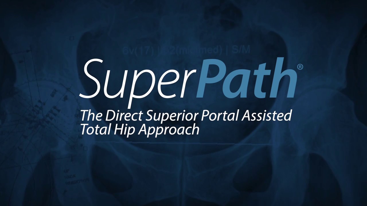 Microport Superpath - YouTube