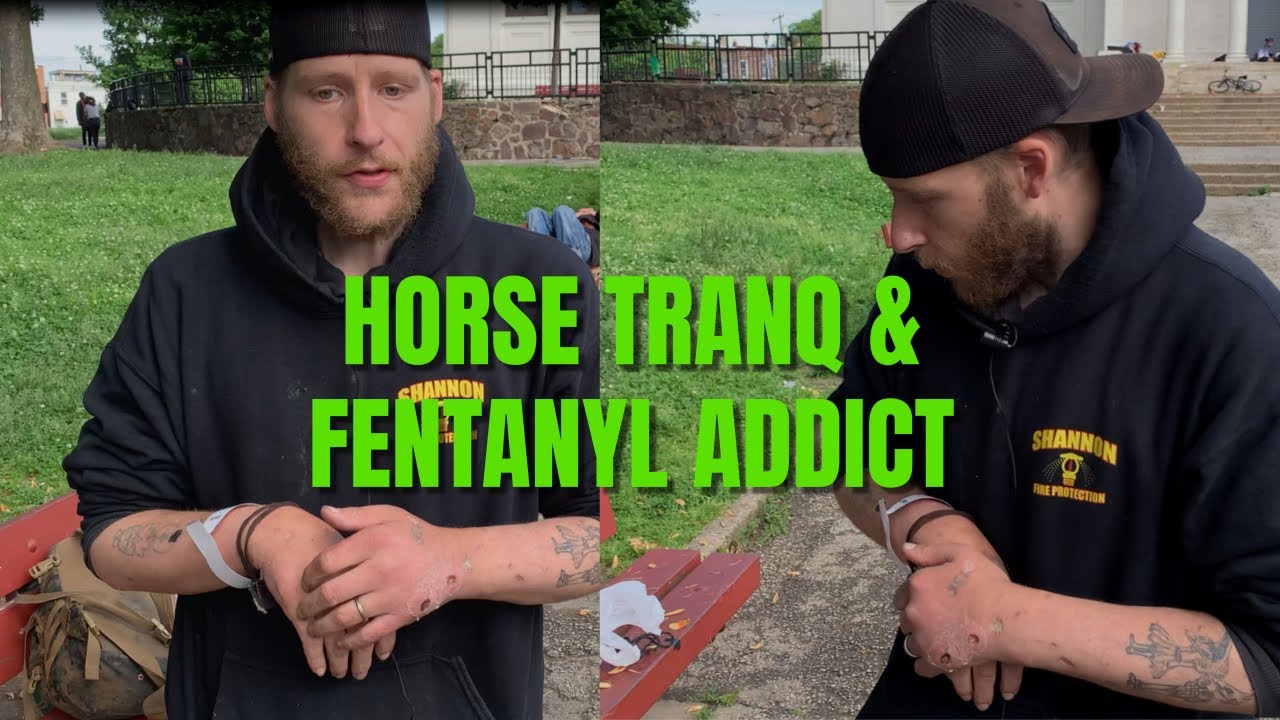 Addicted To Horse TranQ And Fentanyl - Mathew - YouTube