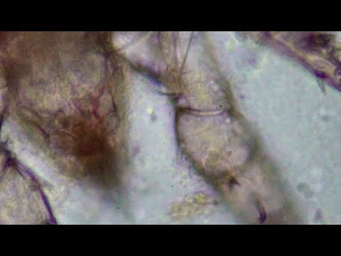 Suitable food of the mite Histiostoma feroniarum - YouTube