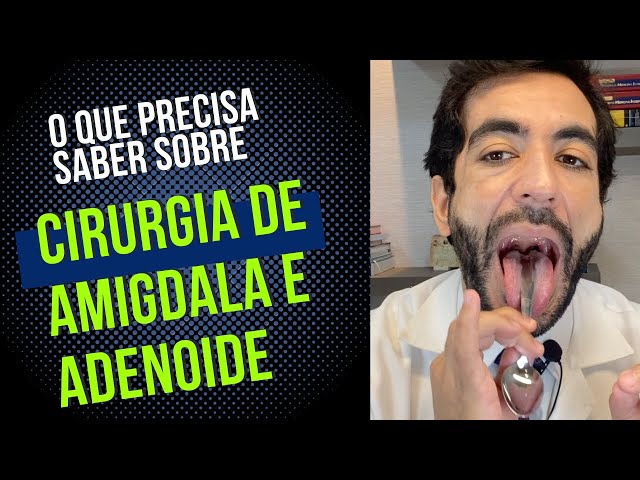 Procedimento De Amigdalectomia Passo A Passo