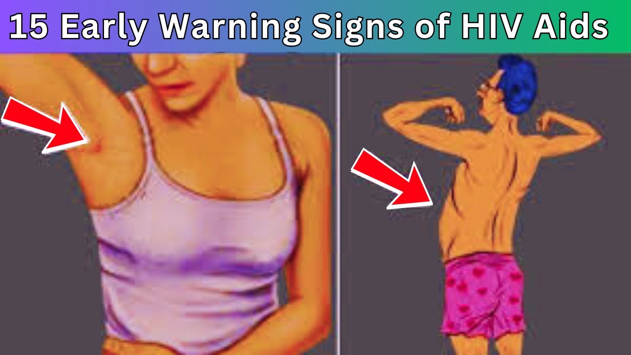 15 Warning Signs of HIV | AIDS Symptoms in Men | HIV Symptoms in MEN ...
