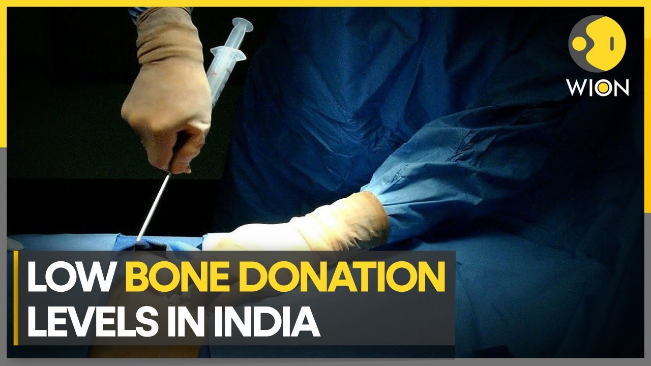 Bone Donation CRISIS in India's Financial Capital: Demand-Supply ...