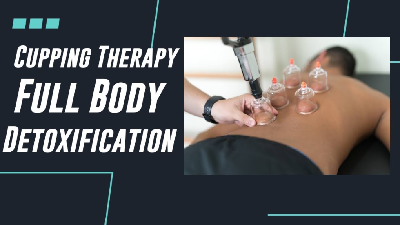 Cupping Therapy // Full Body Detoxification // Dr.Parth Vasani ☎️ 87584 ...