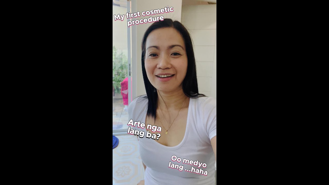 Smile Transformation Vlog: Emax Crown and Teeth Whitening - YouTube