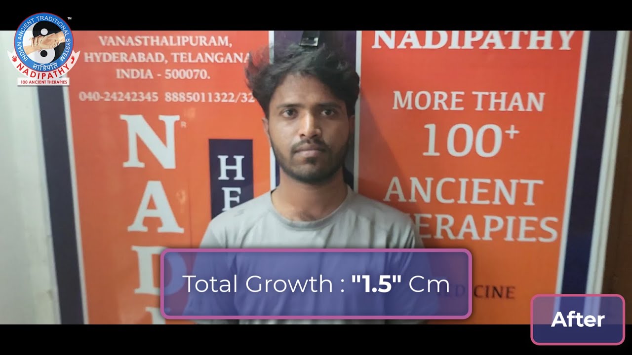 "1.5 CM" Natural Height Growth | Nadipathy Height Treatment | Dr P ...