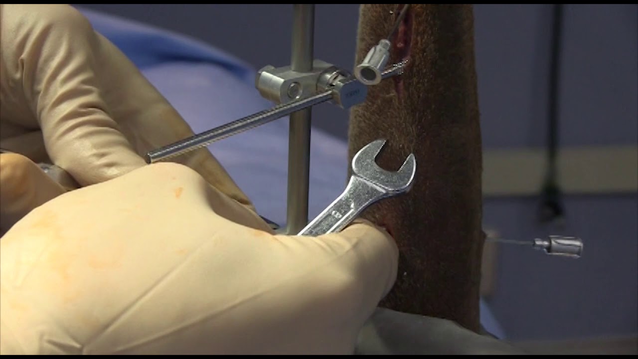 SK ESF System | Two-Wrench Counter Torque - YouTube