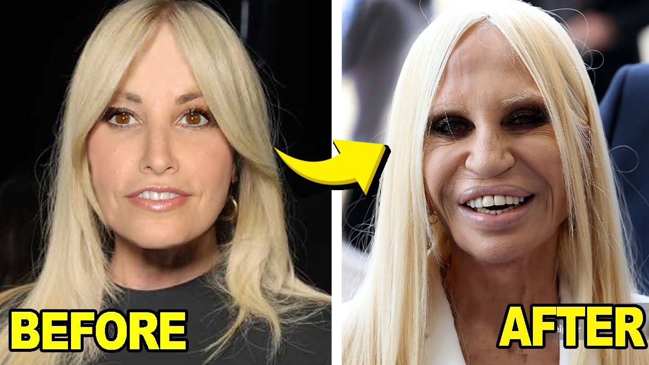 Top 20 Celebrities with TERRIBLE Plastic Surgery - YouTube