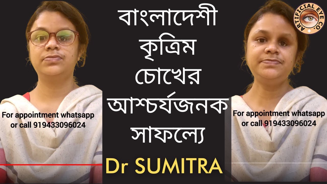 Bangladeshi Girls's Artificial Eye - Amazing success | Dr Sumitra - YouTube