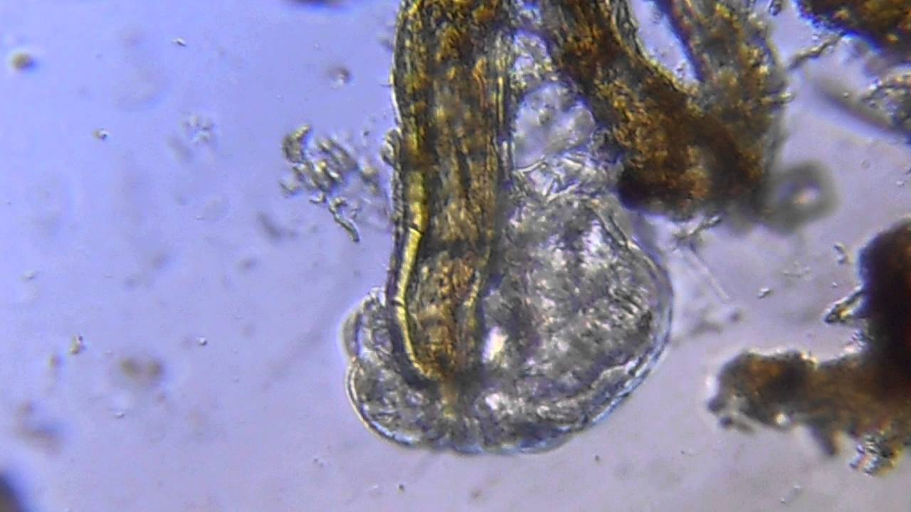Tardigrade microscopy - YouTube